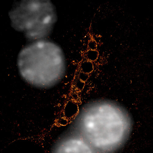 Liverboat - Researchers Uncover Microstructural Elements in Liver Cells ...