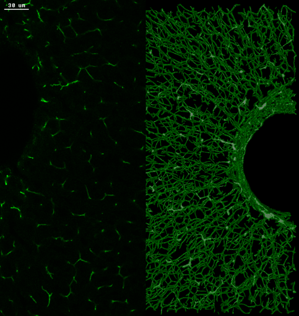Better Diagnosis with 3D Model of Human Liver Tissue - Zerial Lab